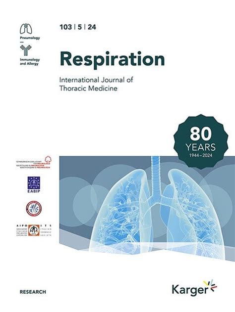 Shape Sensing Robotic Assisted Bronchoscopy Versus Computed Tomography