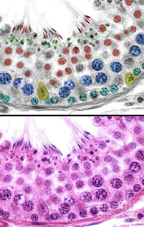 Spermatogenesis In Human Testicle Photograph By Jose Calvo Science