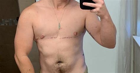 Progress Album On Imgur