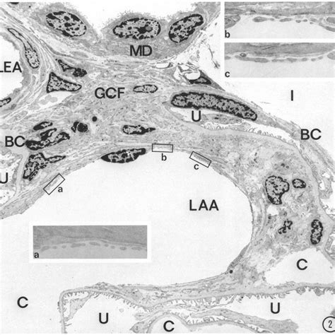 Podocyte Foot Processes Pfp In The Parietal Layer Of Bowmans Capsule