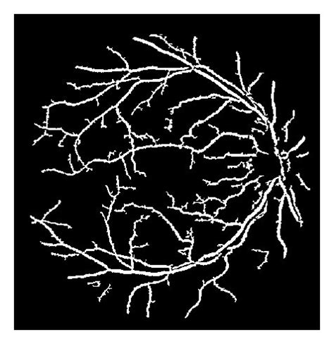 Adaptive Thresholding Using Different ASM Range Information On DRIVE
