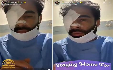 شاهد أول تعليق لـ عبودكا بعد خروجه من غرفة العمليات يروي تفاصيل