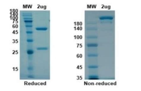 Sars Cov 2 Spike S1 Human Anti Sars Cov 2 Clone H4 Novus Biologicals