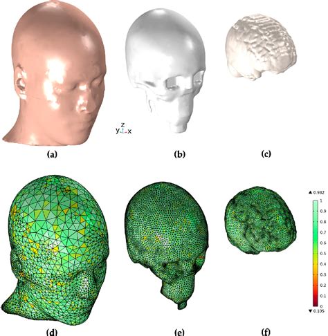 Figure 2 From A Combined Magnetoelectric Sensor Array And Mri Based