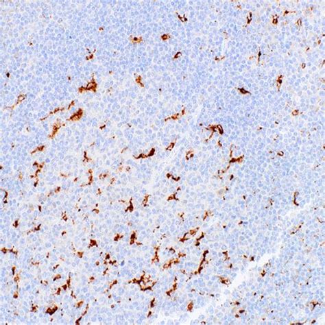 Cd68 Antibody Immunohistochemistry Fardadazma