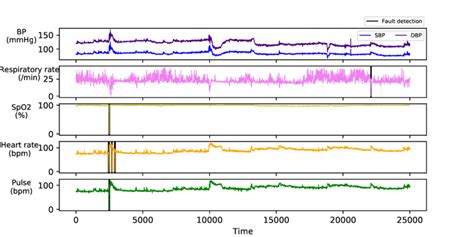 Fault Detection For Patient 221 Download Scientific Diagram
