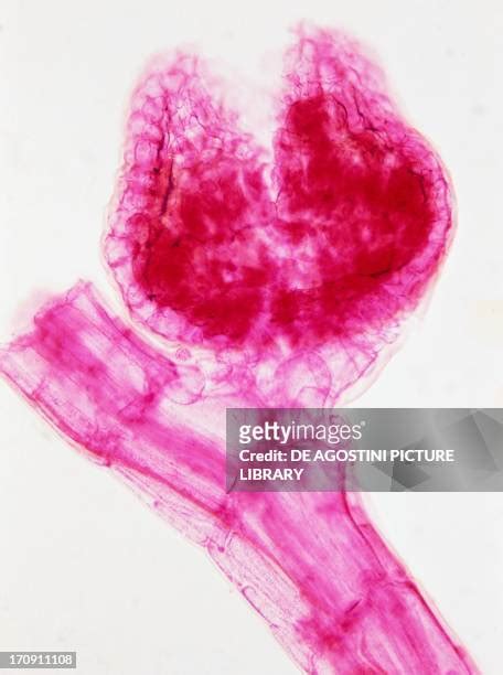 Polysiphonia Under Microscope
