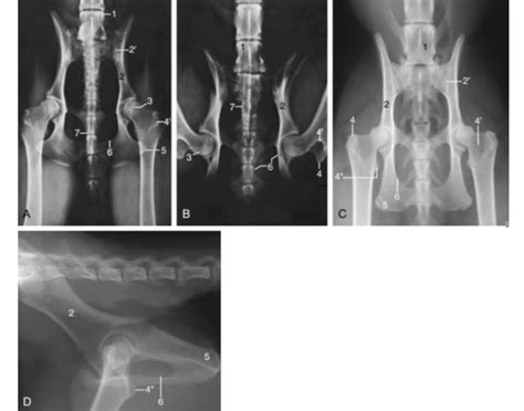 Hip Joint X Rays — Printable Worksheet