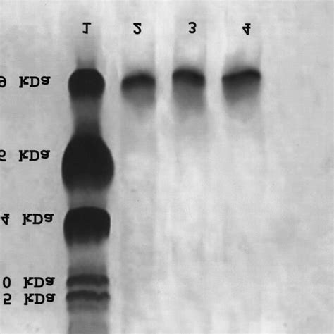 Sds Polyacrylamide Gel Electrophoresis Of Ca Purified By Affinity Gel