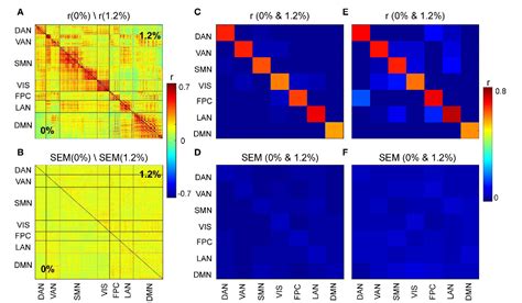 Figure 1 From Sevoflurane Alters Spatiotemporal Functional Connectivity Motifs That Link Resting