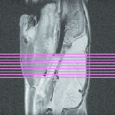 Positioning Of Slices Download Scientific Diagram