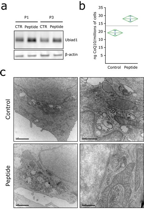 Modulation Of Ubiad1 Expression And Coq10 Synthesis By Synthetic