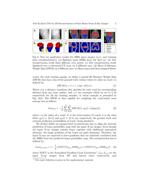 end to end convolutional neural network for 3d reconstruction of knee