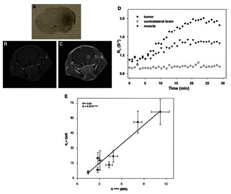 Validation Of Dce Mri With Qar Method Axial Views Of The Tumor From A Download Scientific