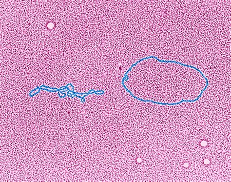 Lambda Phage Dna Tem Stock Image C032 0369 Science Photo Library