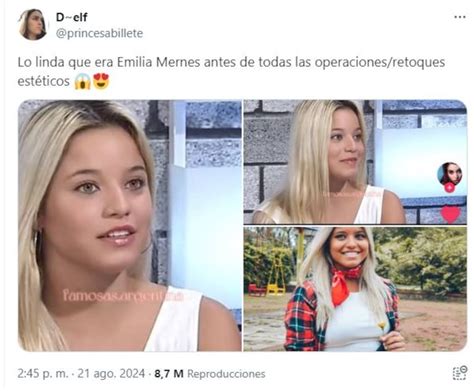 Emilia Mernes Mostró Su Impactante Cambio Físico Y Sorprendió A Sus
