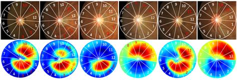 Visualizing The Attention Map Which Is Used To Highlight The