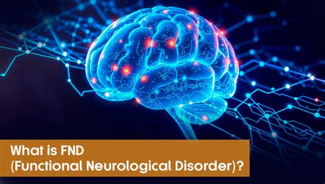 Functional Neurological Disorder Fnd Sukino Healthcare