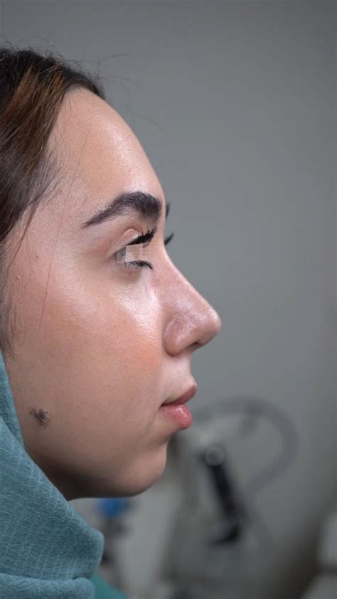 ‎دکتر سیما ندافی جراحی بینی بلفاروپلاستی اتوپلاستی‎ ‎دامن از دست من خسته مکش، ای مادر که