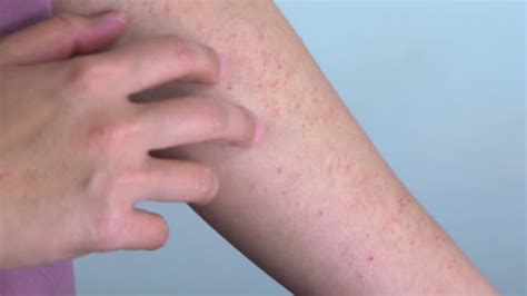 184 Fingernail Scratch Stock Videos Footage And 4k Video Clips Getty