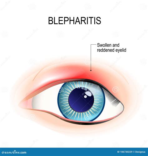 Diagram Cat Eyelid Diagram Wiringschemacom