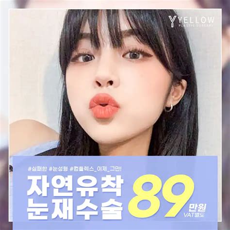 옐로우성형외과 2024 💛옐로우 눈재수술💛