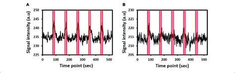 Functional Magnetic Resonance Imaging FMRI Signal Time Curves From Download Scientific