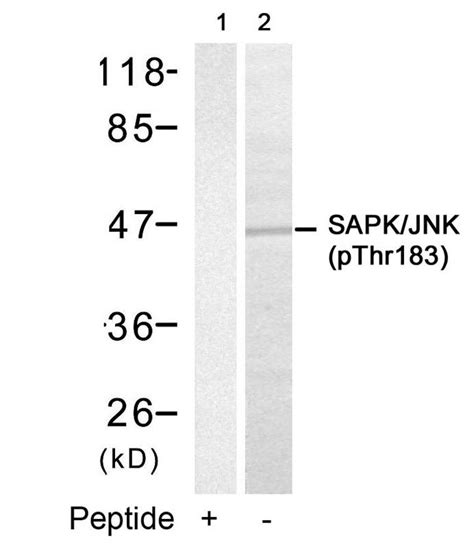 Sapk Jnk Phospho Thr183 Antibody Sab Signalway Antibody