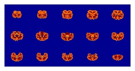 Segmentation Results For The Ibsr Volume 7 Some Slices Of The Axial Download Scientific