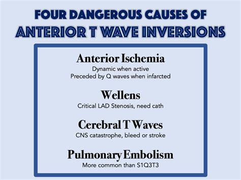 T Wave Inversion