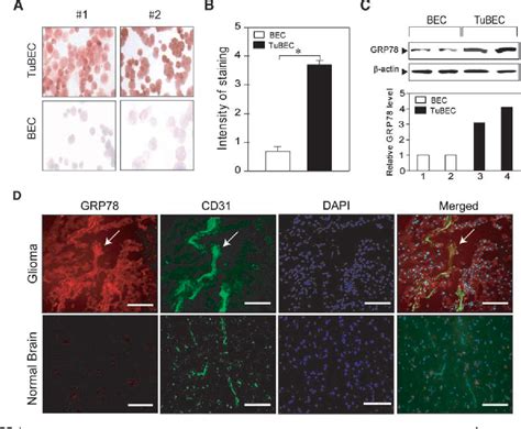 Figure 1 From Stress Chaperone Grp78bip Confers Chemoresistance To