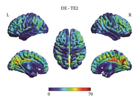 Cbf Maps Obtained With Different Readouts De Dual Echo Se