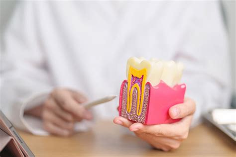 What Happens When A Cracked Tooth Goes Untreated Alexandria Old Town