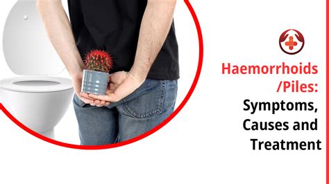 Haemorrhoids Piles Symptoms Causes And Treatment