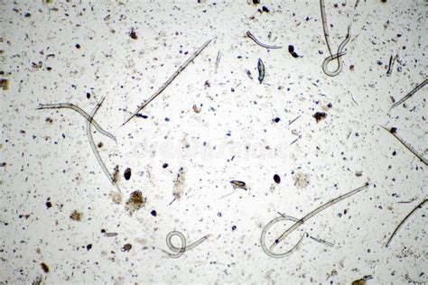 Hookworms Microscope Hookworm Male Ancylostoma Duodenale Prepared