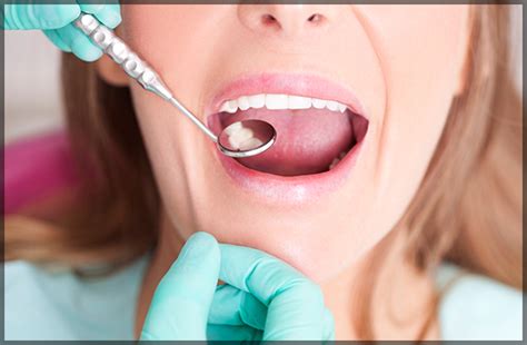 Bad Dental Routine You Need To Replace Ottawa Dentist