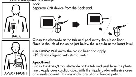 Defib Pad Placement Defib Pad Placement