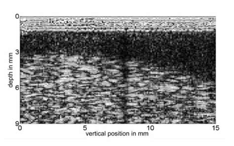 Laser Ultrasonic Library Of Publications