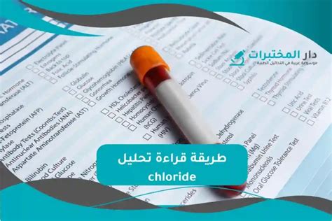 تحليل Iron المعدل الطبيعي نسبة الارتفاع والانخفاض دار المختبرات