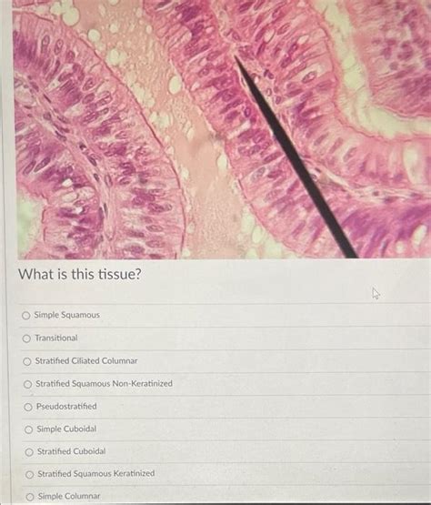 [solved] Please Help What Is This Tissue Simple Cuboidal S