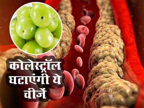 Cholesterol Kam Karne Ke Upay In Hindi नसों में चिपका कोलेस्ट्रॉल