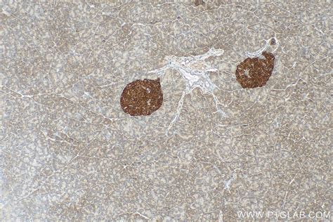 syn1 antibody 30549 1 ap proteintech