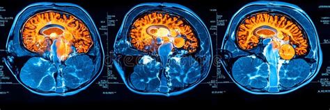 Intelligence Revolutionizing Medical Diagnostics And Healthcare Transformation Ai Analyzing