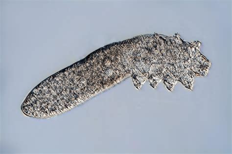 Demodex Found On My Forehead R Microscopy