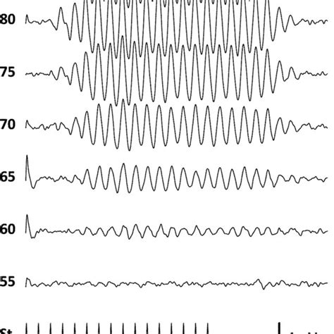 3 Spectrogram Of A Variety Of Narwhal Sounds For Ease Of Display These Download Scientific