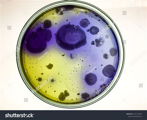 Microbial Culture Media Definition Types Examples Uses 59 Off