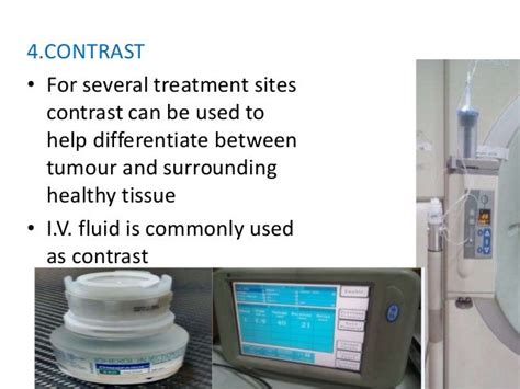 Importance Of Ct Simulator In Radiotherapy