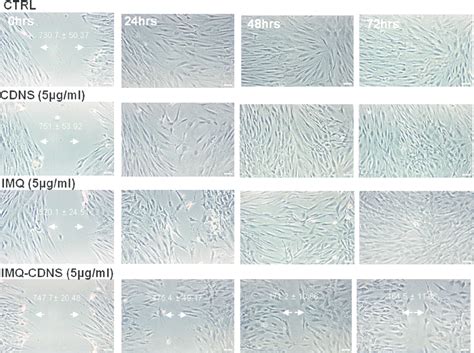 Representative Micrographs Of Scratch Wound Closure Assay Following