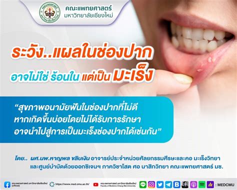ระวัง แผลในช่องปาก อาจไม่ใช่ ร้อนใน แต่เป็น มะเร็ง คณะแพทยศาสตร์