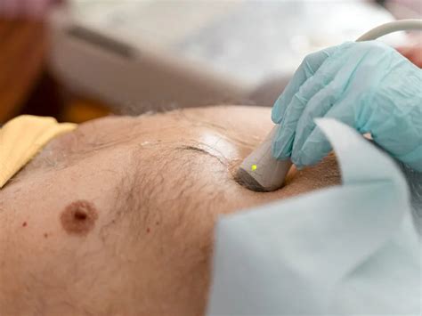 Tumor Demystified Causes Symptoms And Treatment Explained